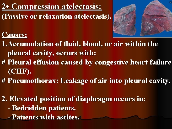 Respiratory system Lecture 1 Atelectasis and Disturbances of