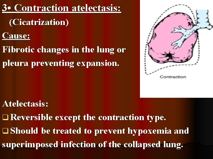 Respiratory system Lecture 1 Atelectasis and Disturbances of
