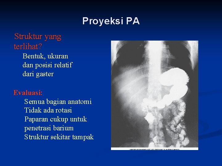 Radiografi sistem traktus gastrointestinal dan hepatobilier Oleh dr