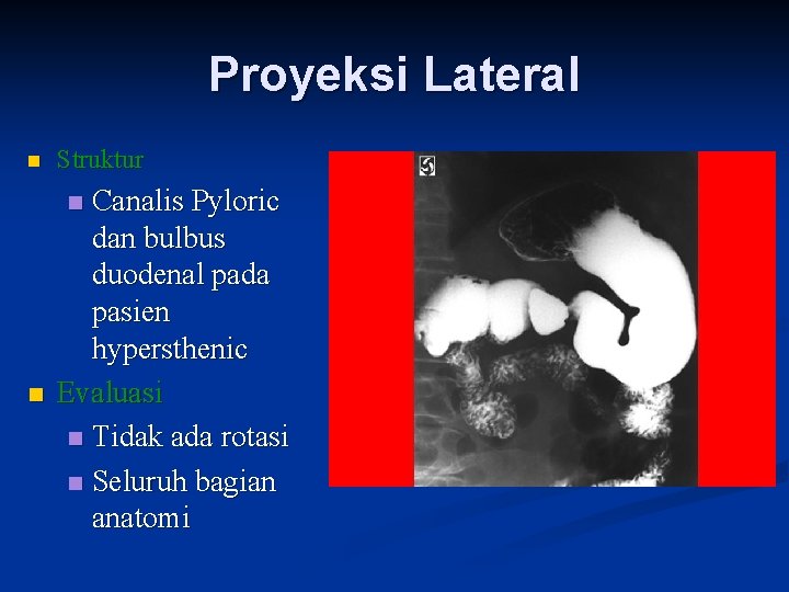 Radiografi sistem traktus gastrointestinal dan hepatobilier Oleh dr