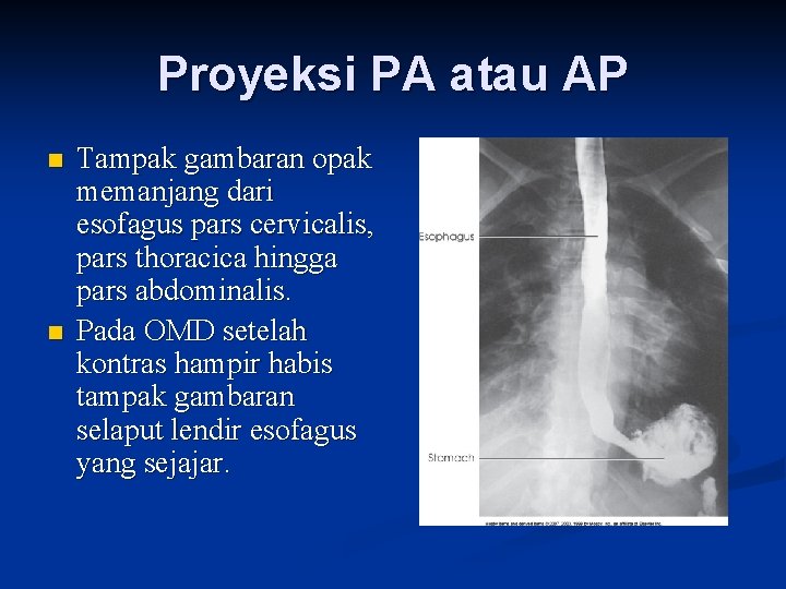 Radiografi sistem traktus gastrointestinal dan hepatobilier Oleh dr