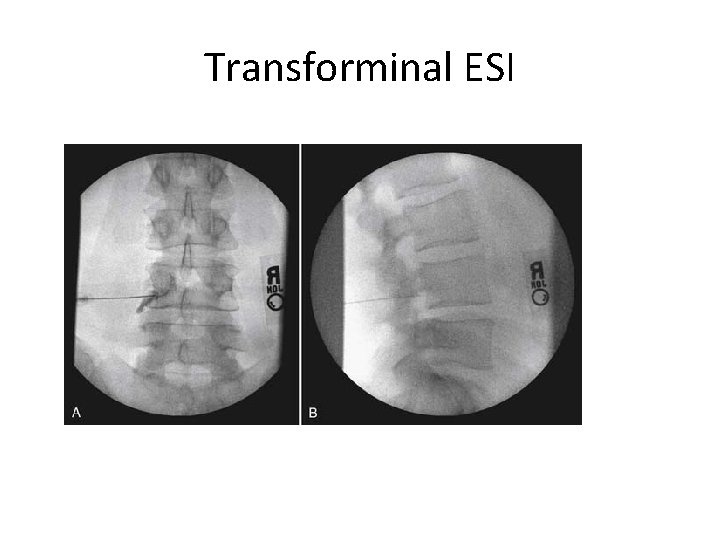 What is this Presentation really about Someone asked