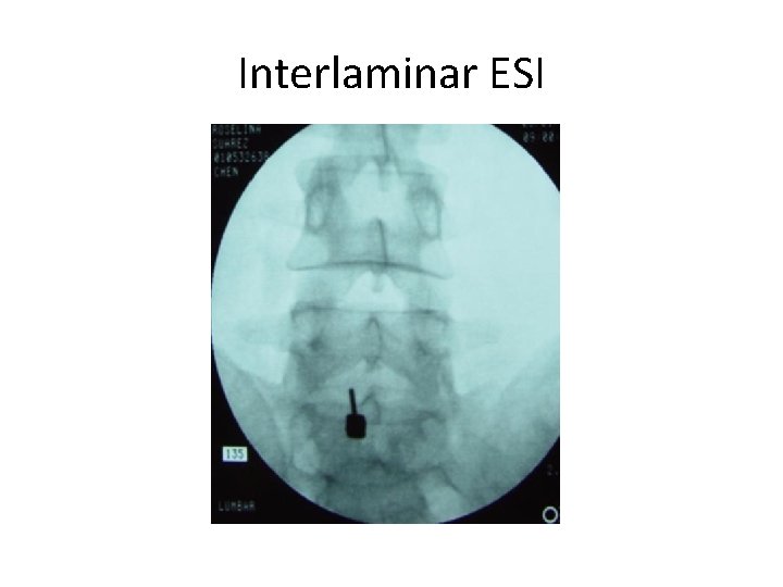 What is this Presentation really about Someone asked