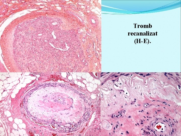 Tulburrile circulaiei sanguine i limfatice II II Hemodynamic