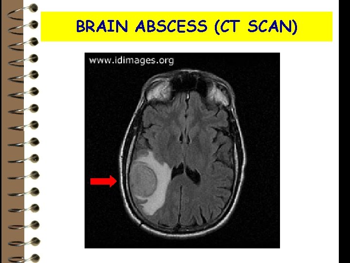 THERAPY OF ANAEROBIC INFECTIONS Douglas Black Pharm D