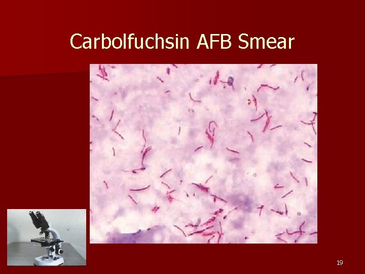 Epidemiology Global Taiwan Pathogenesis and transmission Diagnosis ...