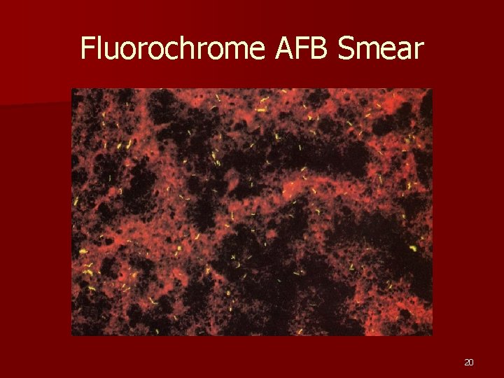 Epidemiology Global Taiwan Pathogenesis and transmission Diagnosis ...