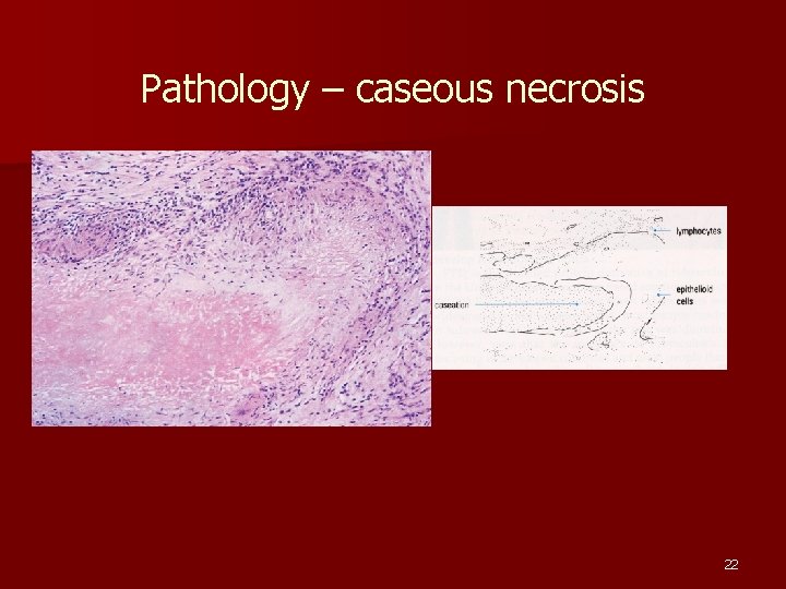 Epidemiology Global Taiwan Pathogenesis and transmission Diagnosis ...