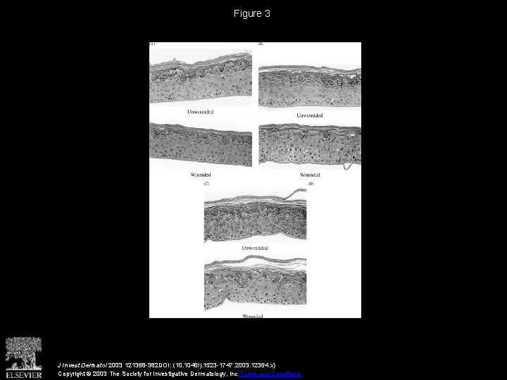 Gene Expression Profile of Tissue Engineered Skin Subjected