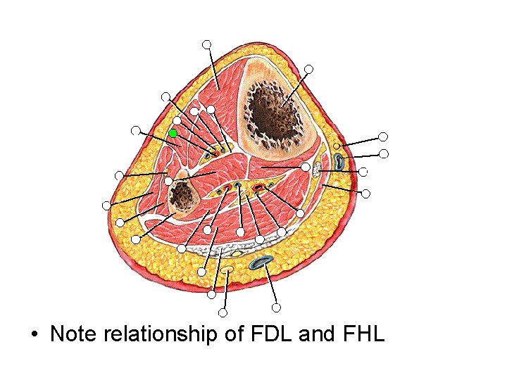 Muscles of the Leg Anterior Compartment Tibialis anterior