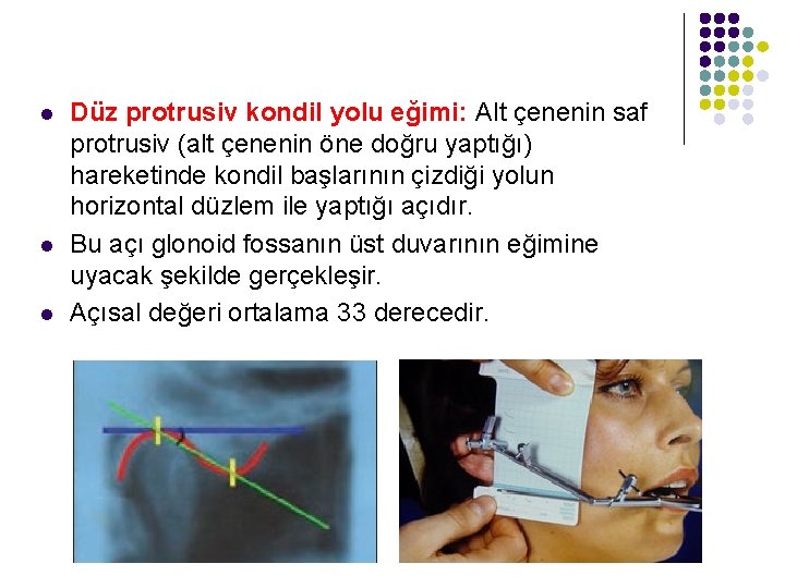 l Artklasyon Kanunlar l Artiklasyon teorisinin amac disiz