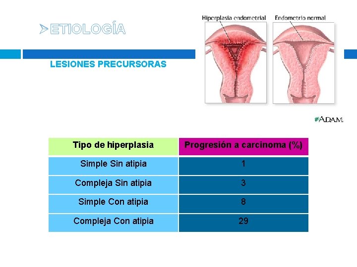 HIPERPLASIA ENDOMETRIAL Gijn Martnez Jovan Edel Kuri Ayala
