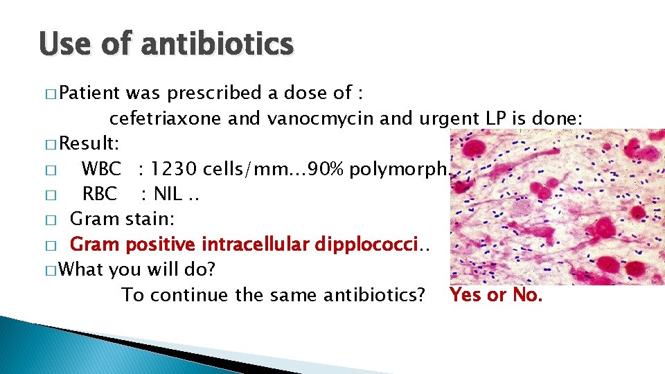 Introduction Antibiotic Chemical produced by a microorganism that