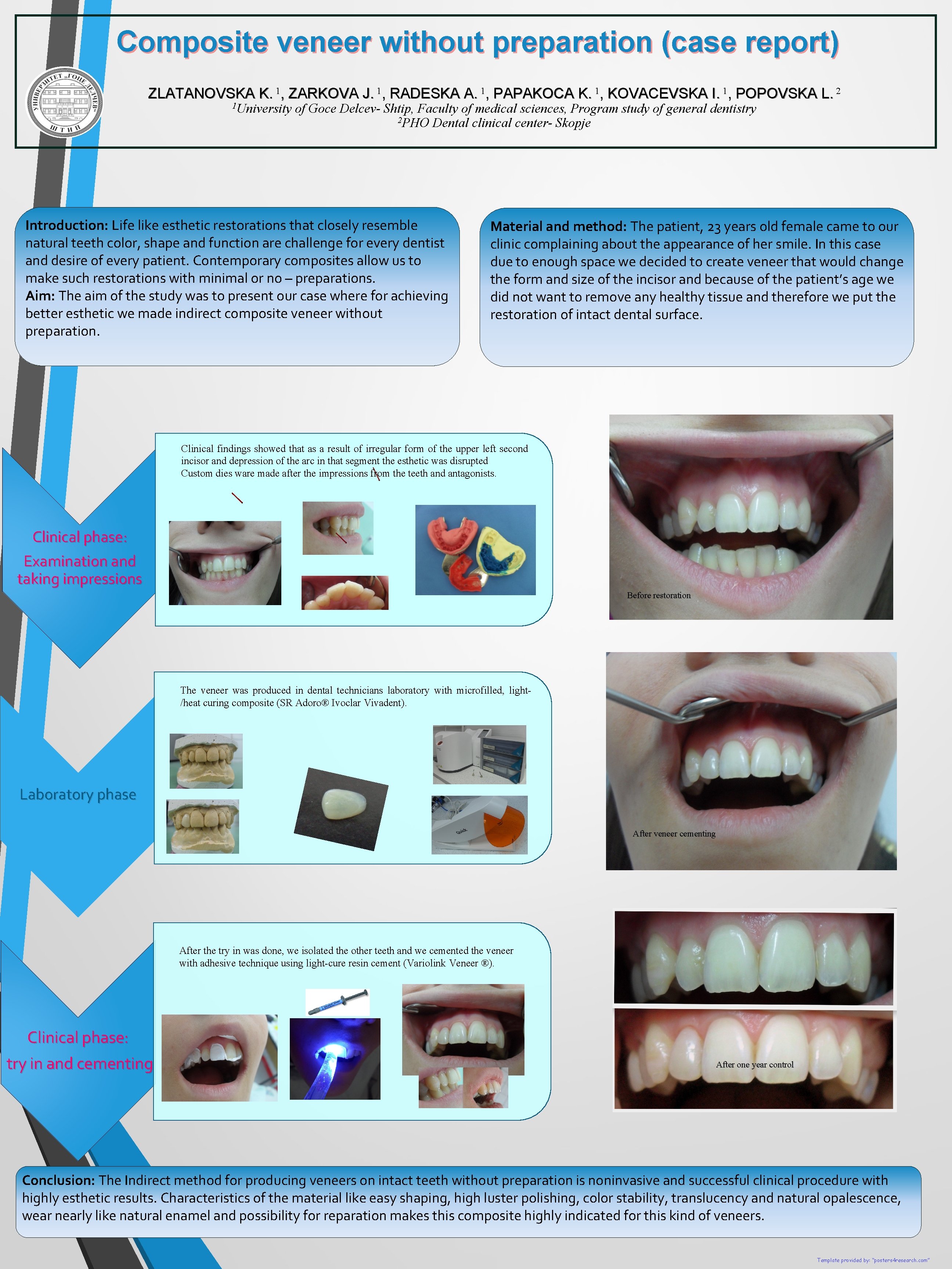 Composite veneer without preparation case report ZLATANOVSKA K