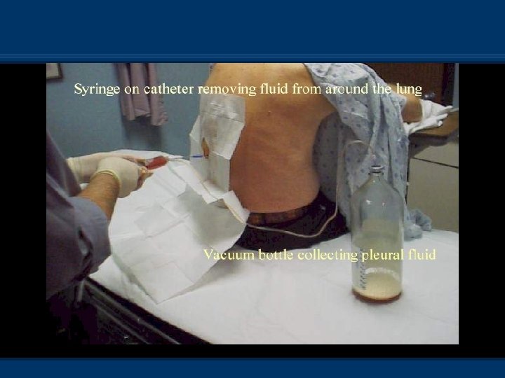 Respiratory System Diagnostic Procedures Risk Factors for Respiratory