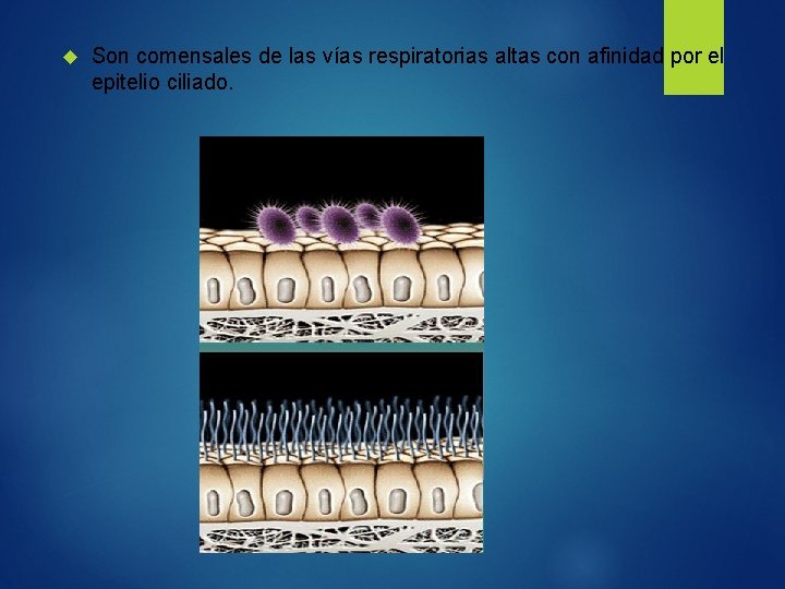 Traqueo bronquitis infecciosa canina causada por Bordetella Integrantes