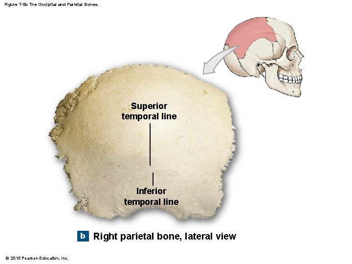 Chapter 7 The Axial Skeleton Lecture Presentation by