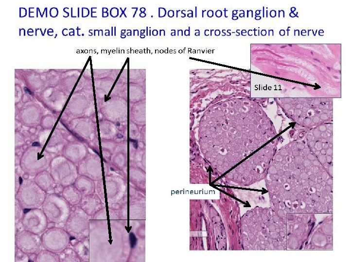 Rough Endoplasmic Reticulum and Polysomes Slide 148 Commercial