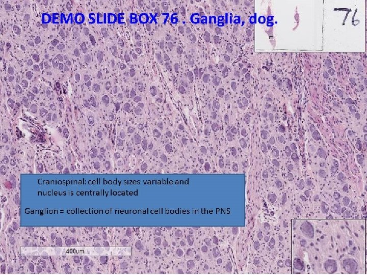 Rough Endoplasmic Reticulum and Polysomes Slide 148 Commercial