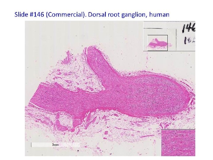 Rough Endoplasmic Reticulum and Polysomes Slide 148 Commercial