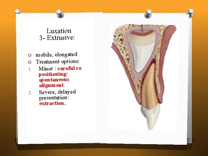 Treatment options for traumatized primary teeth Treatment options