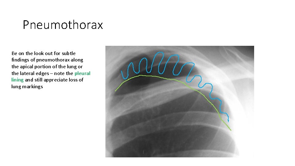 Welcome to Chest Imaging Jeannie Kochkodan Dr Perry