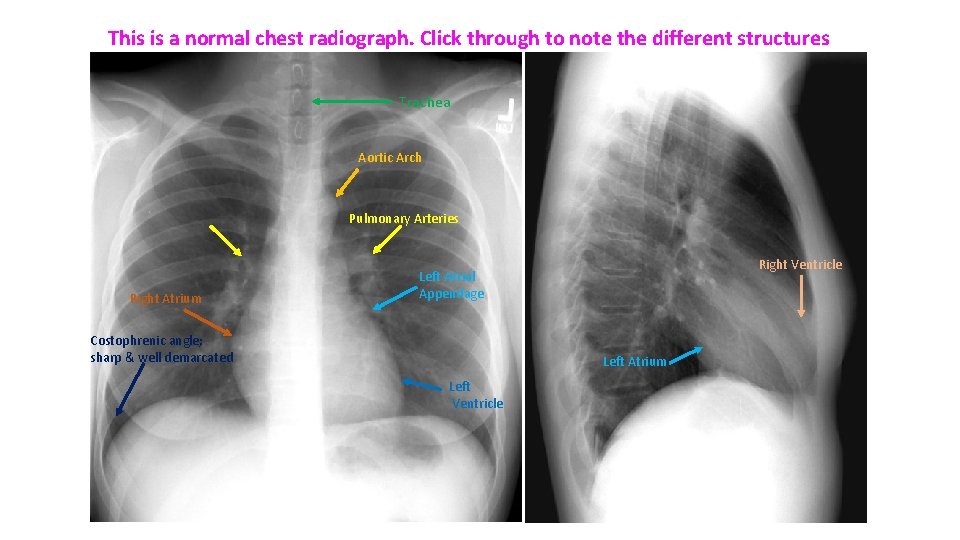 Welcome to Chest Imaging Jeannie Kochkodan Dr Perry