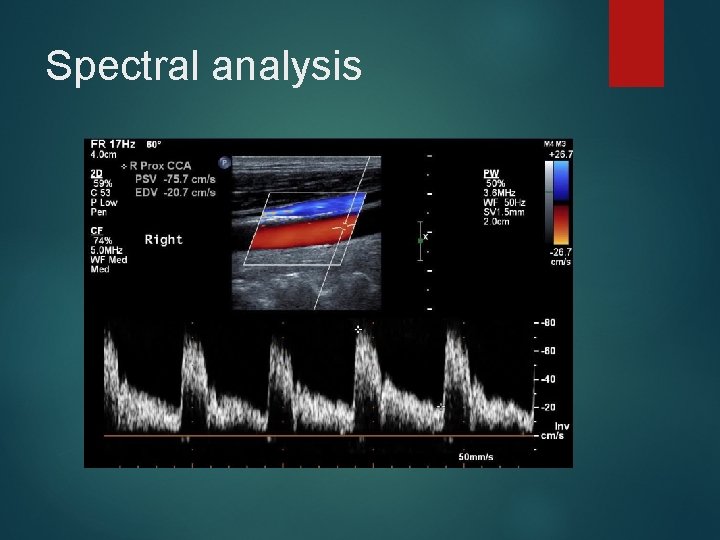 Diagnostic Medical Sonography Program Vascular Technology Holdorf LECTURES