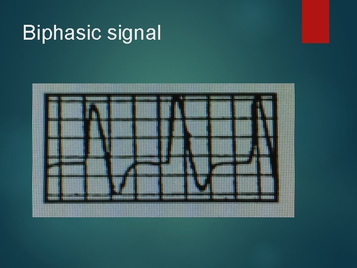 Diagnostic Medical Sonography Program Vascular Technology Holdorf LECTURES