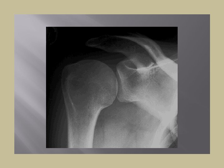 JOINTS OF THE UPPER LIMB Connection of the