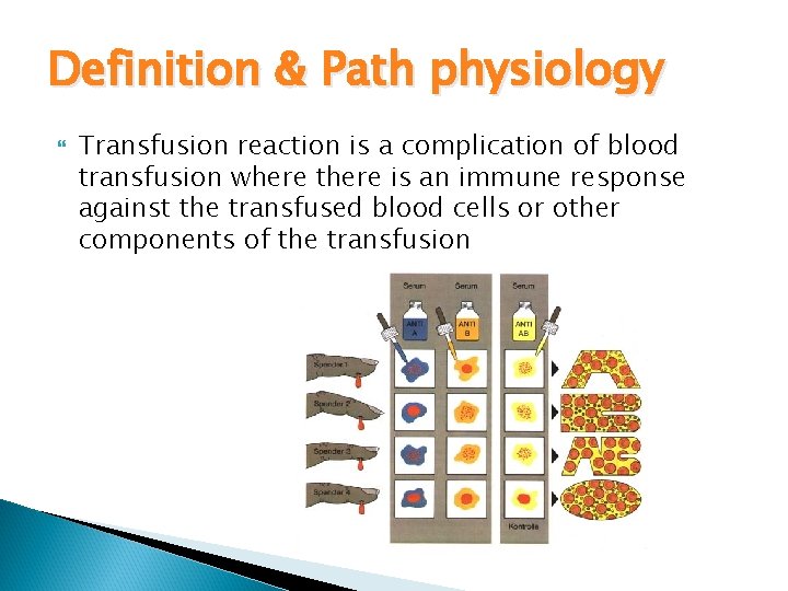 Blood and Blood Product Transfusion Reaction History of