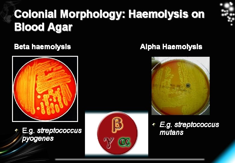 Bacteriological laboratory Diagnosis Process Bacterial Identification ...