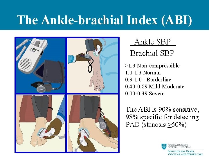 Non Atherosclerotic Peripheral Artery Disease Ido Weinberg MD