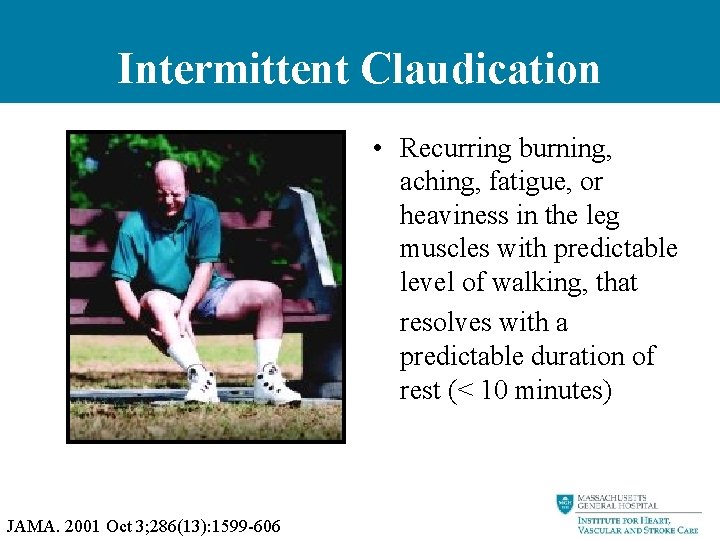 Non Atherosclerotic Peripheral Artery Disease Ido Weinberg MD