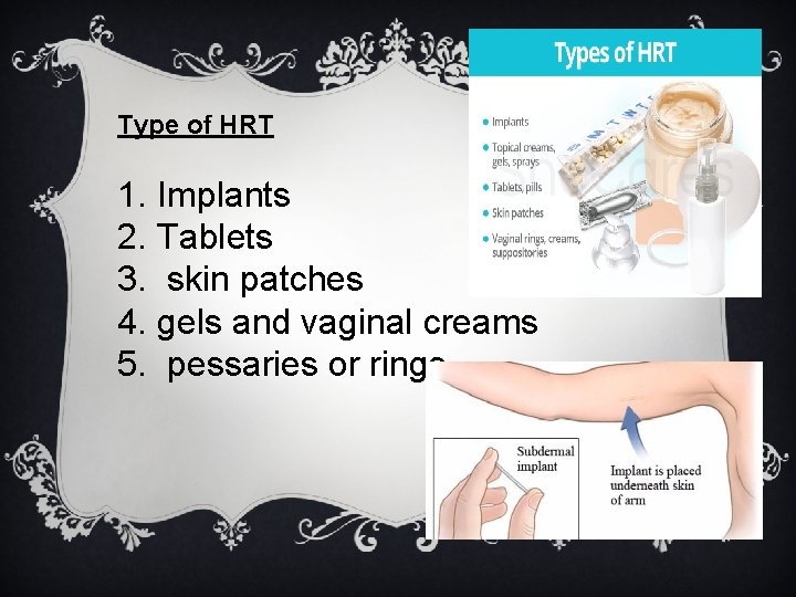 MENOPAUSE Prof Dr Rabea M Ali Overview of