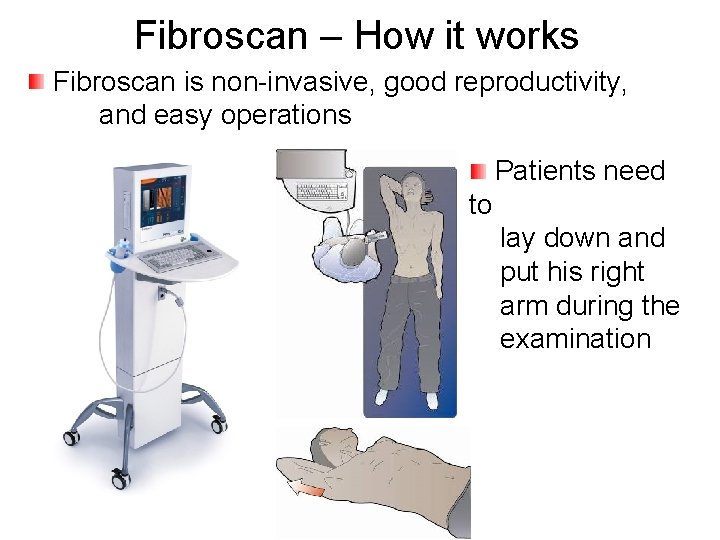 Chronic Hepatitis B Diagnosis When to refer Dr