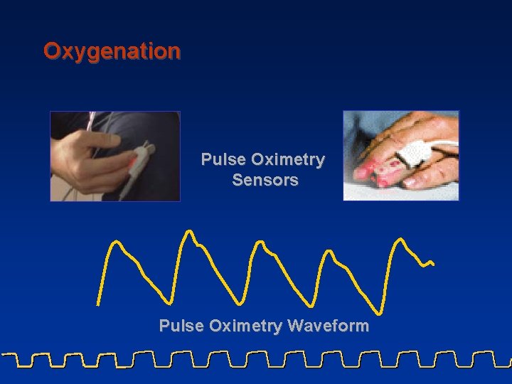 NONINVASIVE CAPNOGRAPHY ALS Blue InService Part III Oxygenation