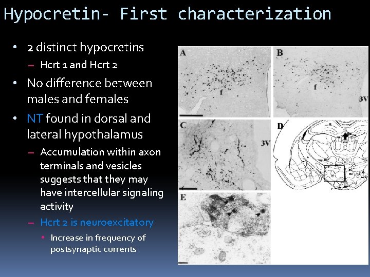 Inger presents ABNORMAL ACTIVITY IN HYPOTHALAMUS AND AMYGDALA