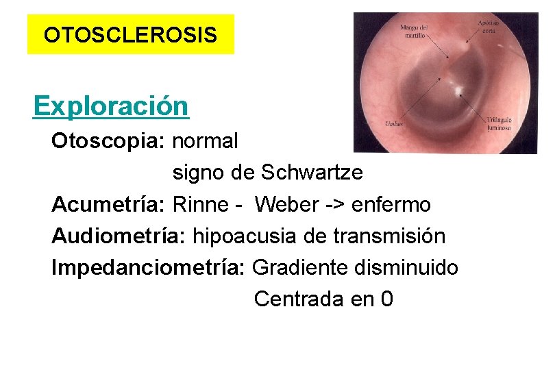 Leccin 2 HIPOACUSIAS DE TRANSMISIN Desarrollo embrionario del