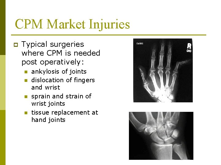 Continuous Passive Motion Hand Rehabilitation Design Team Project