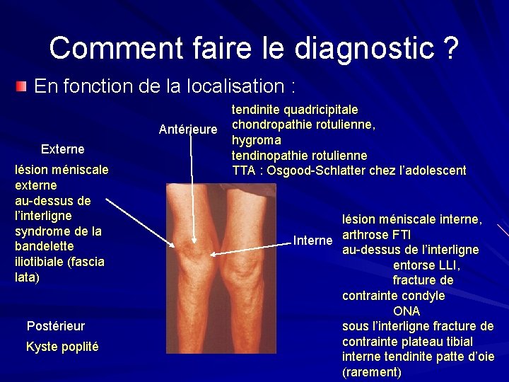 Le Genou Douloureux non Traumatique Dr G Allard