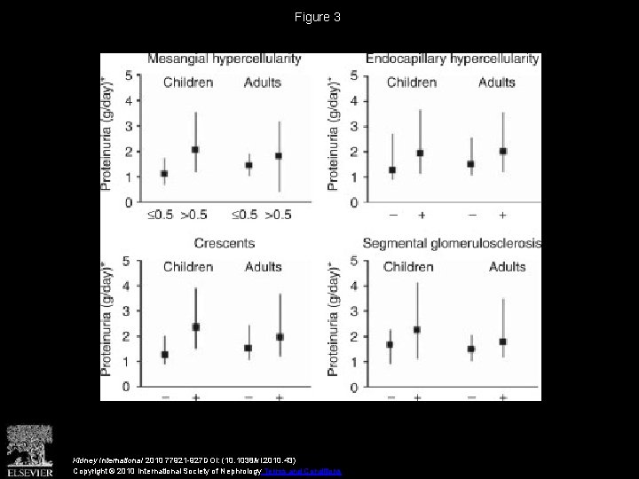 The Oxford Ig A nephropathy clinicopathological classification is