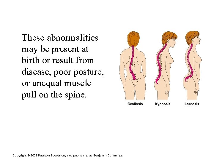 5 PART B The Axial Appendicular Skeleton Power