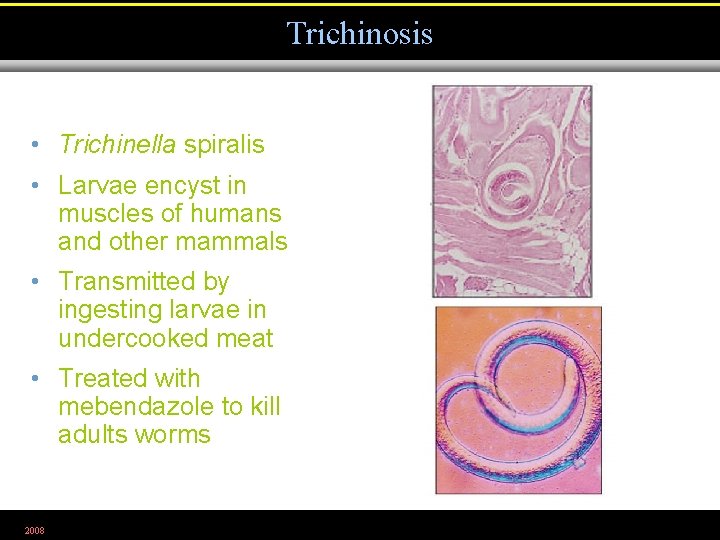 MICROBIOLOGY Chapter 25 Microbial Diseases of the Digestive