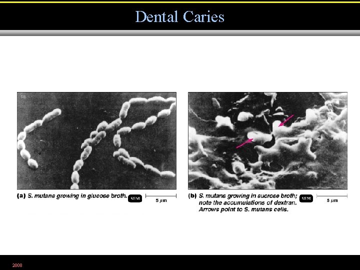 MICROBIOLOGY Chapter 25 Microbial Diseases of the Digestive