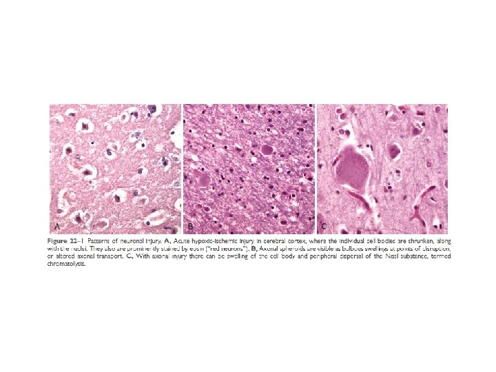 Characteristic features of CNS pathology By Shifaa Al