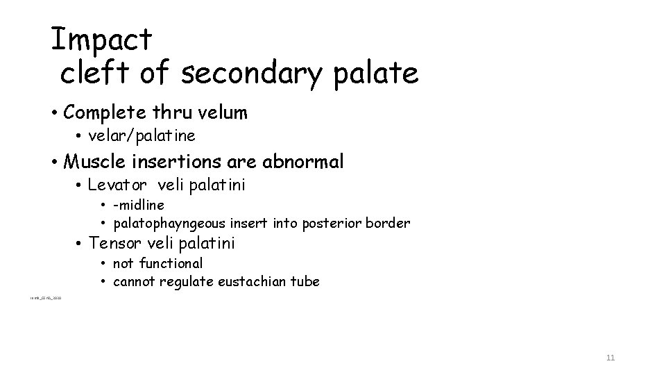Cleft Lip and Palate Katherine Lamb Ph D