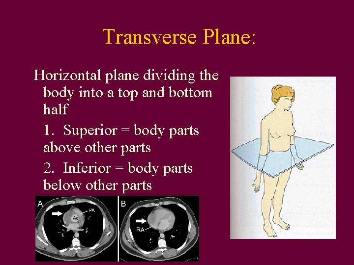 Body Planes Directions and Cavities Objectives Label a