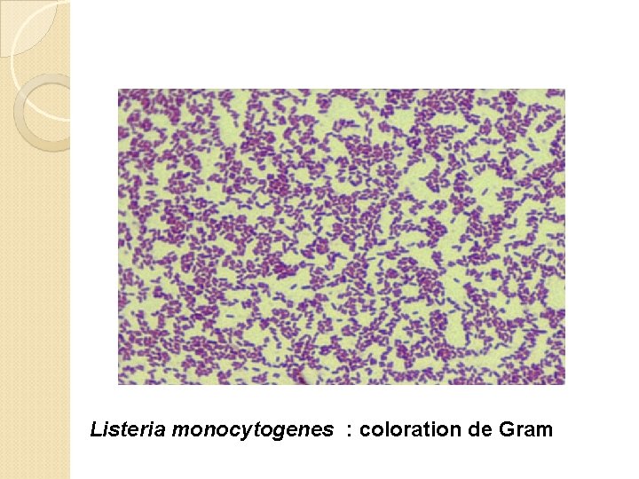 Un modle de bactrie invasive Listeria monocytogenes M
