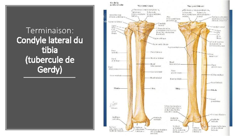 Syndrome de lessuie glace Syndrome de la bandelette